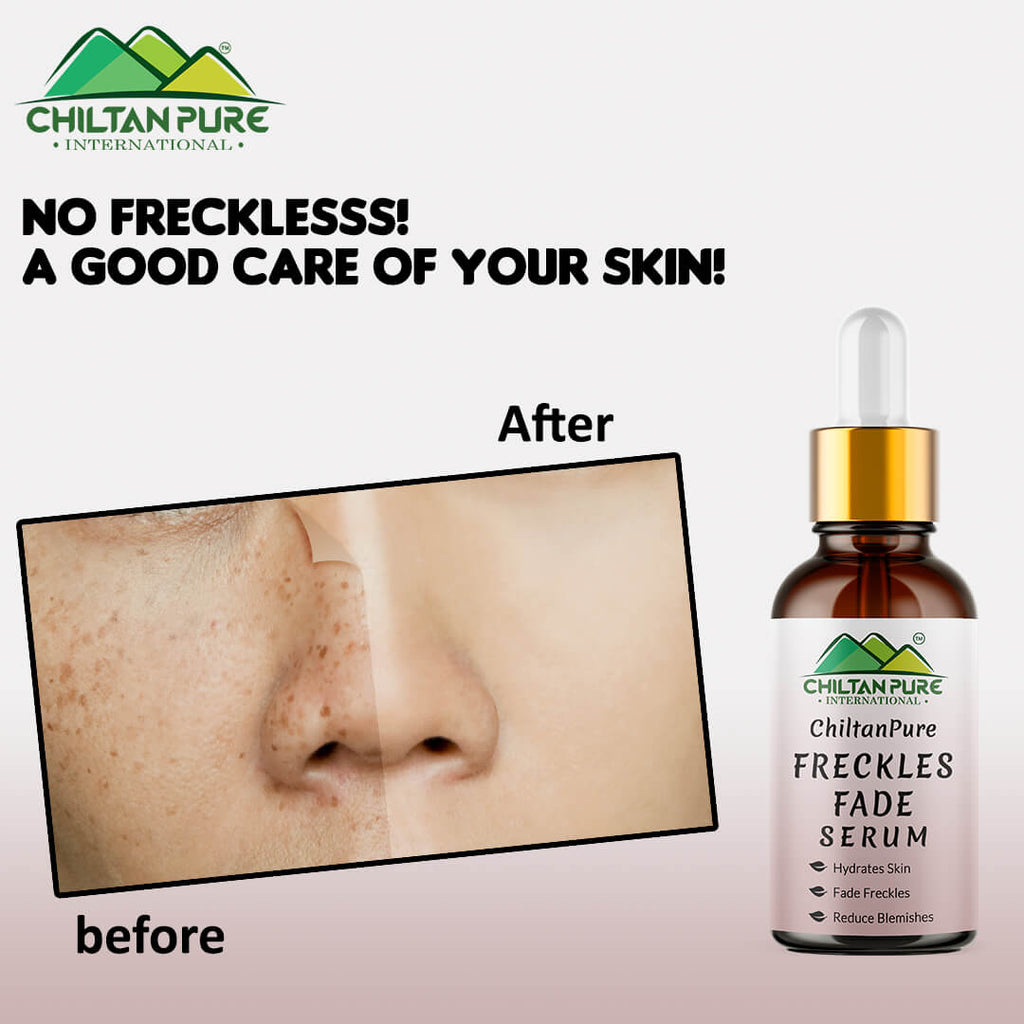 Buy Chiltanpure Freckles Fade Serum at Best Price in Pakistan ...
